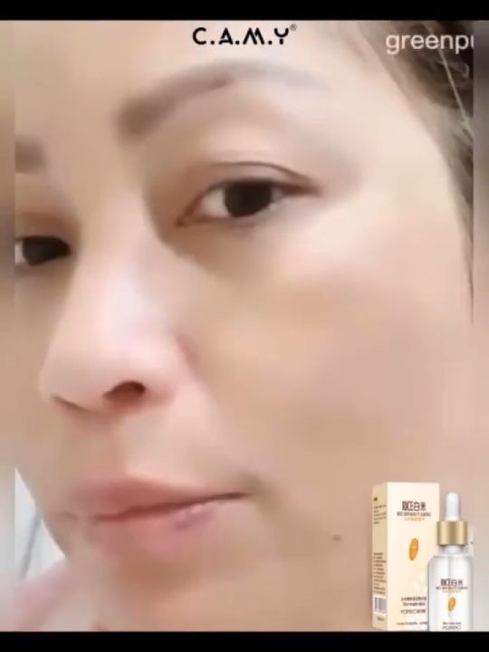 White Rice Anti Wrinkle Serum Niacinamide Essence original Korean White ...