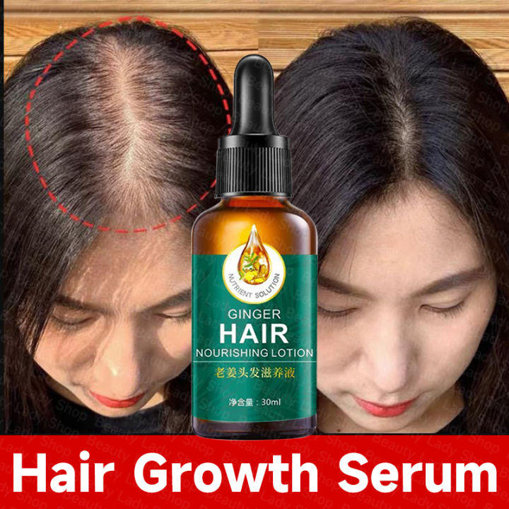 100 Natural Ginger Hair Serum Hair Grower Fast Long Hair Treatment