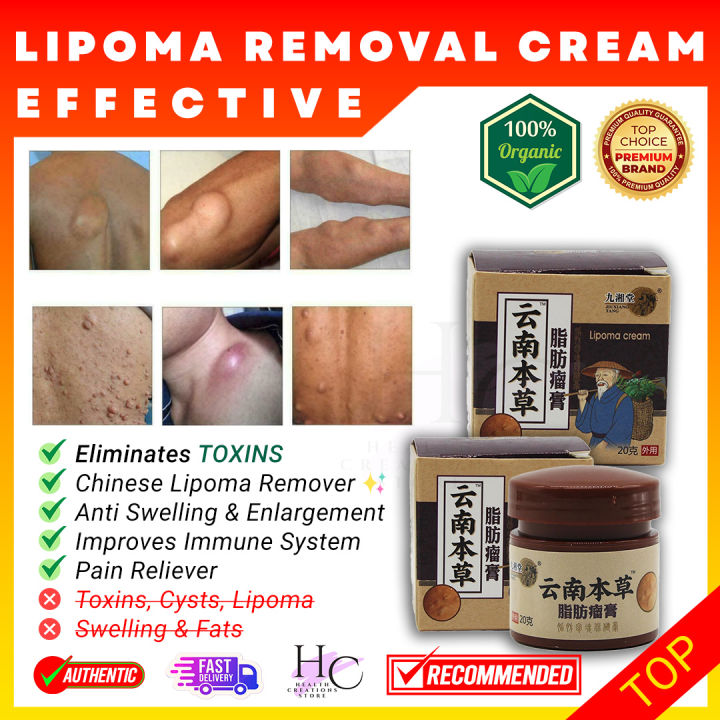 JIUXANG Lipoma Removal Cream Original Lipoma Cream Bukol Original from ...