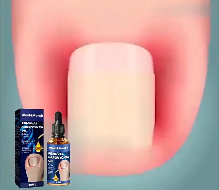 Anti Paronychia Relief Oil Toenails Corrector Repair Liquid Anti Fungal Soften Care Paronychia
