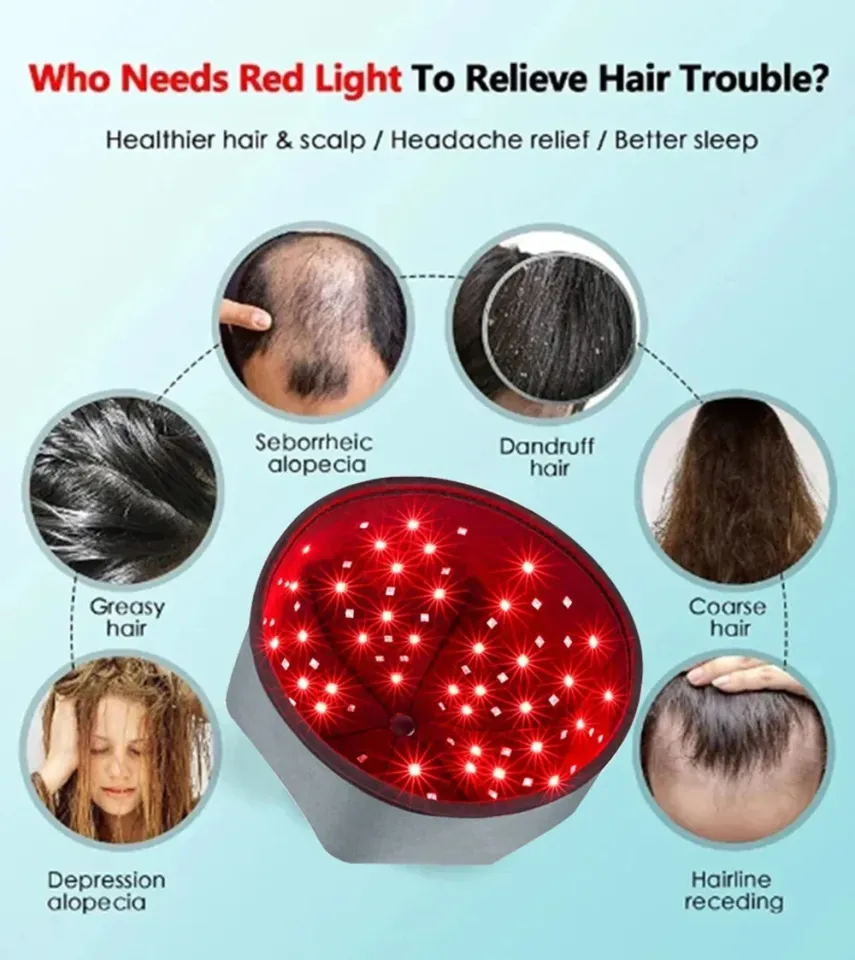 How To Use Red Light Therapy For Hair Loss | Shelly Lighting