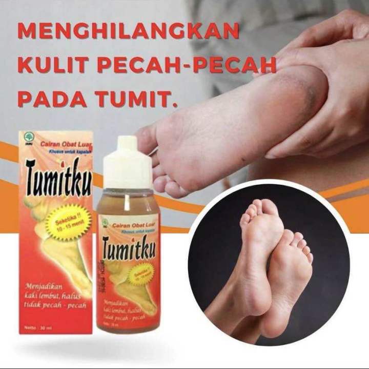 TUMITKU UNTUK KAKI PECAH | Lazada Indonesia