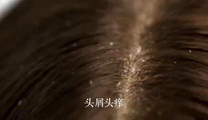 Coconut Oil Moisturizing Hair Care Dandruff Shampoo AZLA Refreshing Oil Control 500ml | Lazada PH