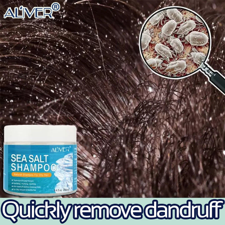 Original Sea Salt Shampoo Anti Dandruff Psoriasis Shampoo Hair ...