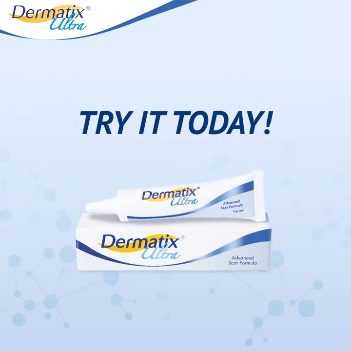 PAYDAY🔥Original Dermatix ultra Scar Gel 15g，Dermatic Acne Scar ...