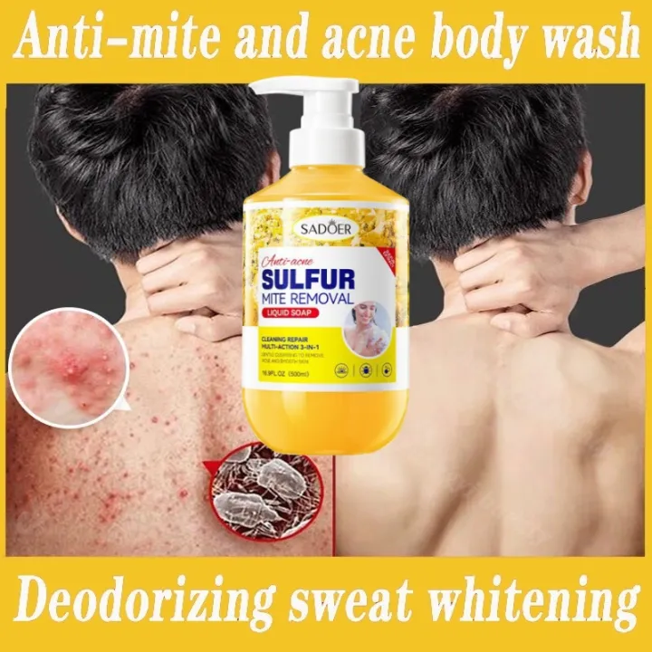 Anti Mite Itching Shower 500ml Acne body wash sabun jerawat badan hilang jerawat Whitening ...