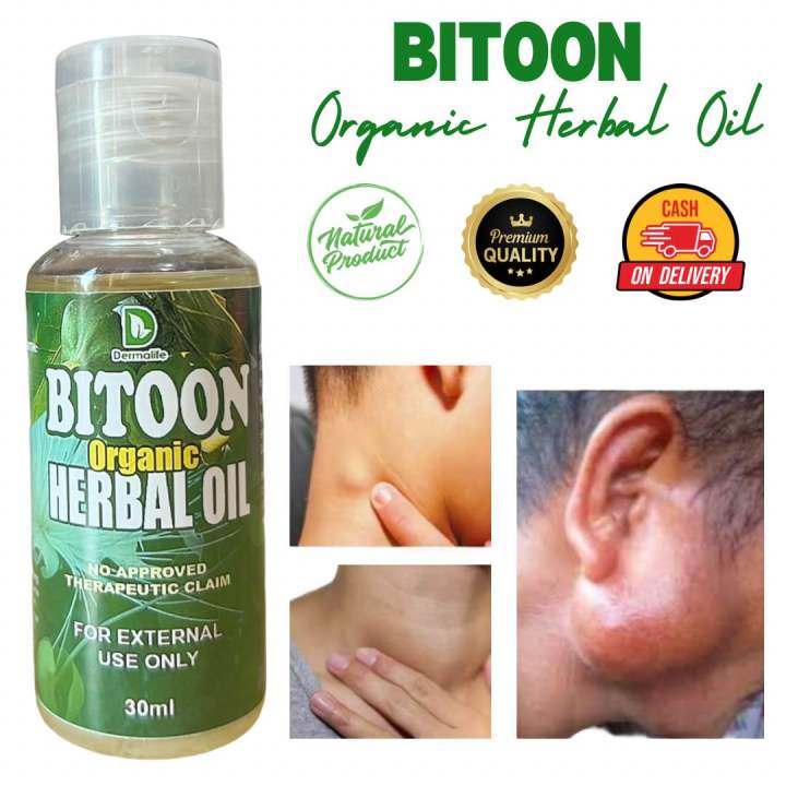 BITOON OIL 30ml - Pantunaw ng bukol, Goiter, Mayoma, Cysts, Tumor ...