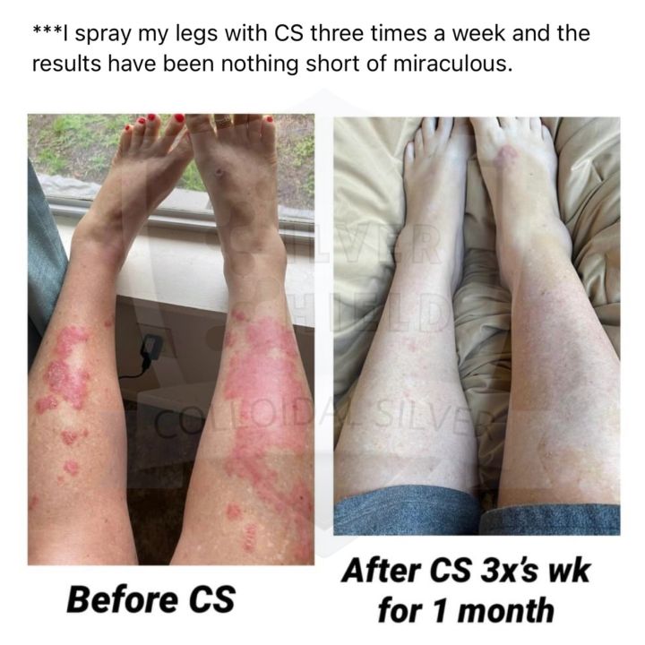 SILVER SHIELD Ionic Nano Colloidal Silver - Spray 100ml | Lazada PH