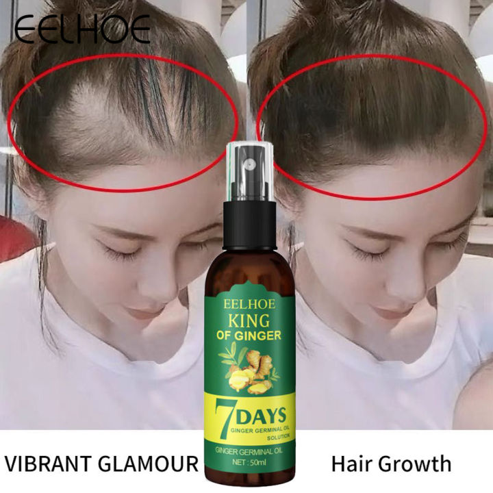 Eelhoe Hair Growth Essence Germinal Serum Essence Oil Natural Hair Loss