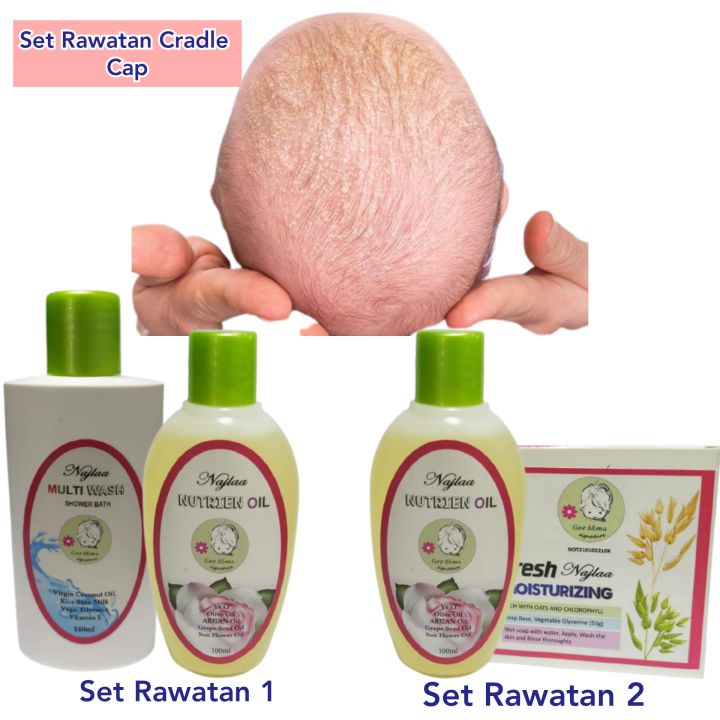 SET Rawatan Kerak Kepala Baby/Set Rawatan Cradle Cap Najlaa/Najla Baby Skincare | Lazada