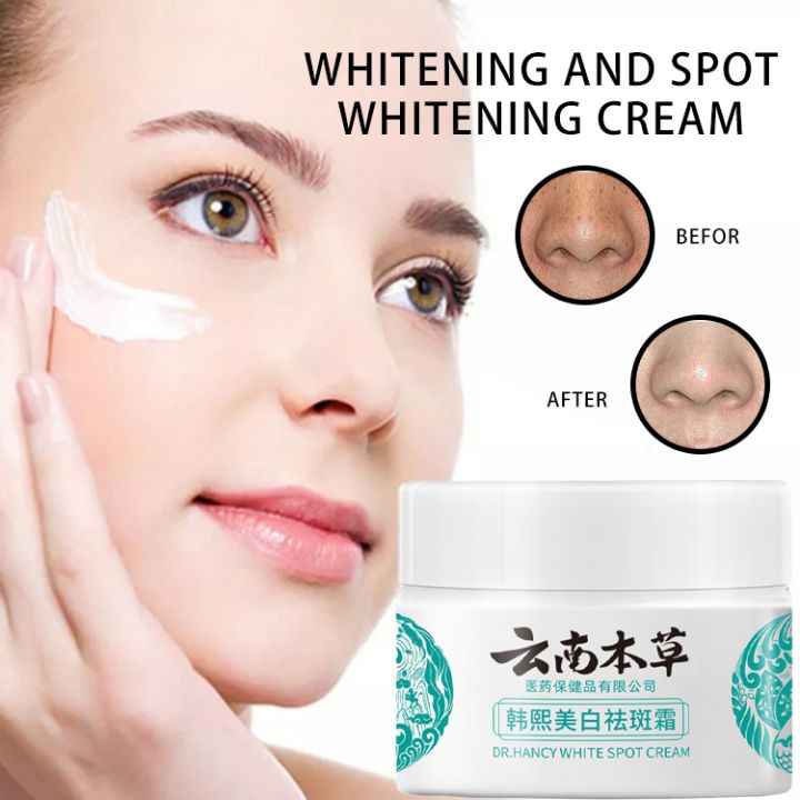 Japanese Melasma Cream Whitening Cream Original for Face Remove Dark ...