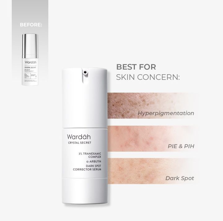 Wardah Crystal Secret 3% Tranexamic Complex α-Arbutin Dark Spot ...