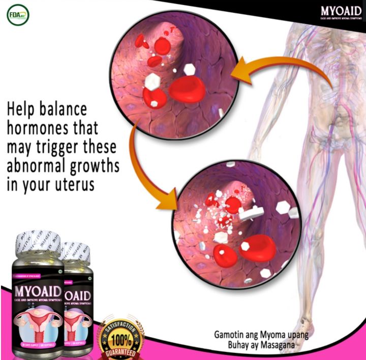 Myoaid gamot sa pcos | Lazada PH