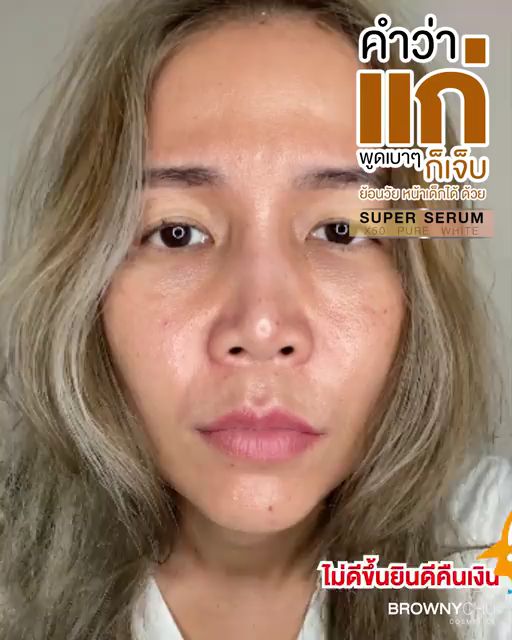 Brownychu Super Serum ล็อกความอ่อนเยาว์ ยกกระชับ ฟื้นฟู ชะลอริ้วรอย ลดฝ้ากระ หน้าอ่อนกว่าวัย เซ ...