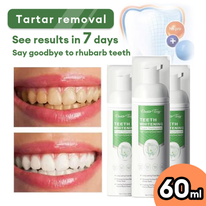 Teeth Whitening Toothpaste Teeteh Cleanning Remove Plaque Stains Tartar ...