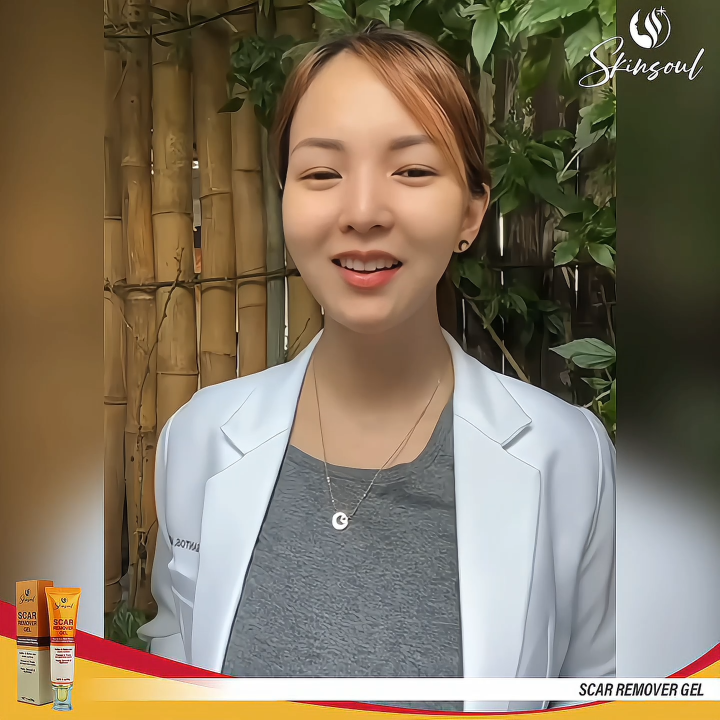 Skinsoul Scar Removal Cream original peklat remover | Lazada PH