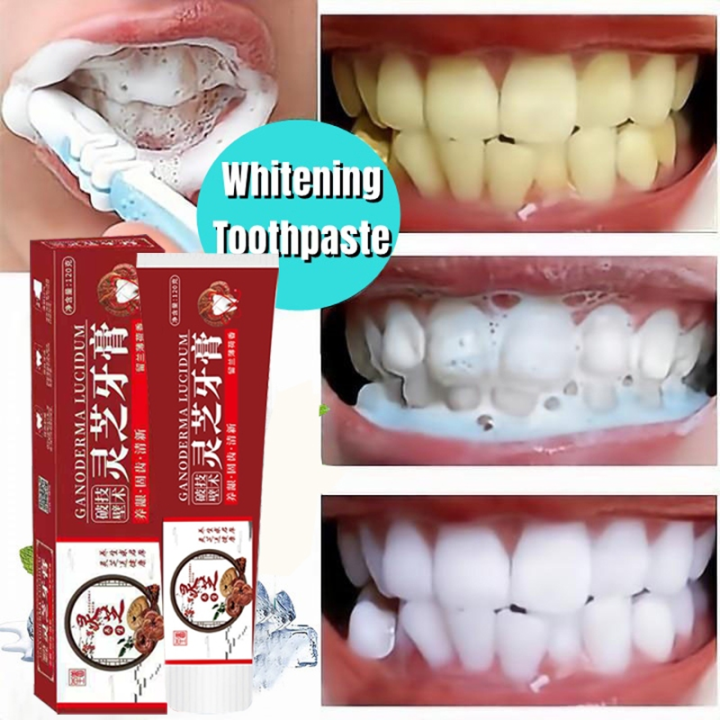 Ganoderma Lucidum Pasta Gigi 120g , Perlindungan Gusi Multi Efek ...