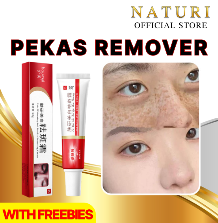 Original Melasma Cream Pekas Remover | Lazada PH