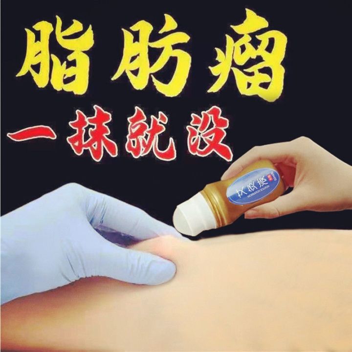 [lipoma 101 healing] designed 36 kinds of subcutaneous lipomas ...