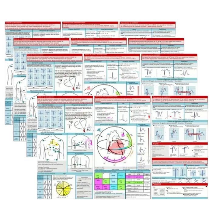 EKG Pocket Guide Ecg Interpretation Pocket Card Horizontal & Vertical ...