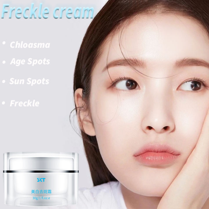 Freckle remover cream Krim jeragat paling berkesan whitening cream for ...