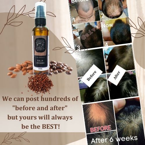 Organic Hair Grower by Zivine Organics | Lazada PH