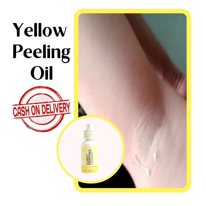 Yellow Peeling Oil 15ml - Skin Peeling - Body Peeling - Underarm ...