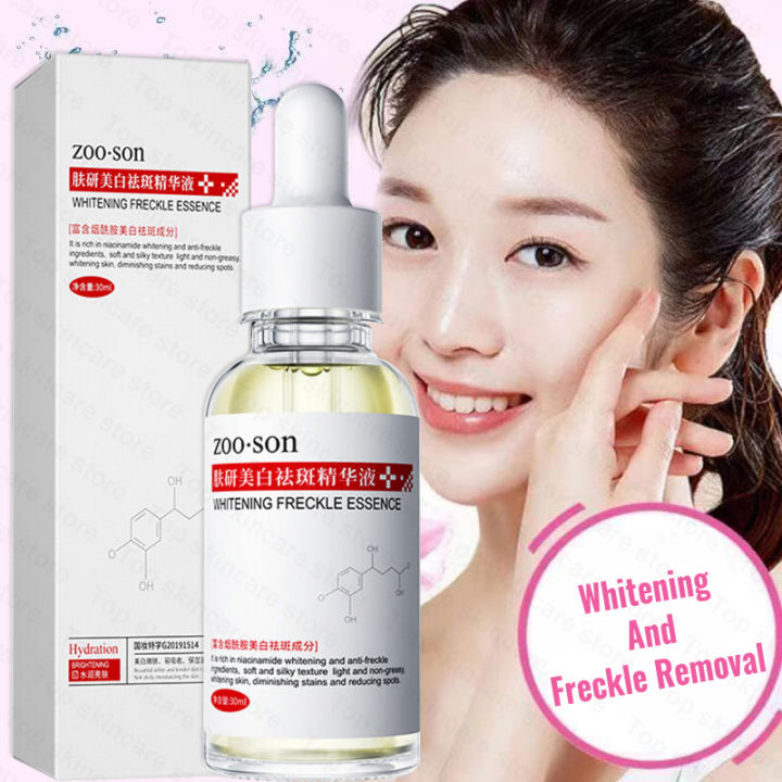 Whitening Freckle Serum 30ml Anti-Freckle Essence melasma and pekas remover serum Freckle Cream ...