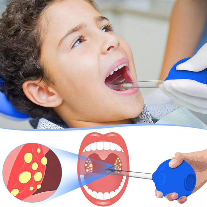 Tonsil Stone Remover Vacuum, Tonsil Stone Remover Kit, Tonsil Stone ...