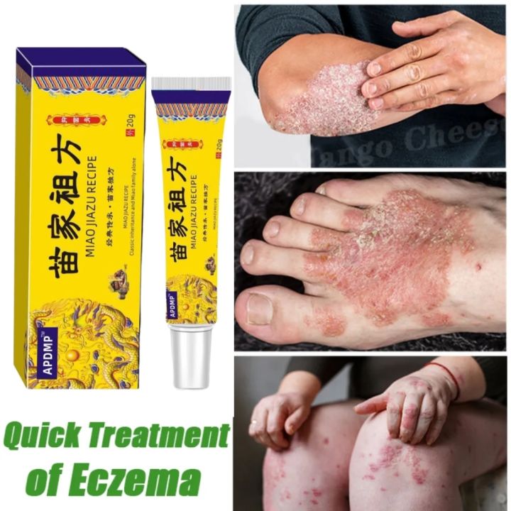 Original Sumifun Eczema Treatment Cream Gamot Sa Kati Kati Atoderma ...