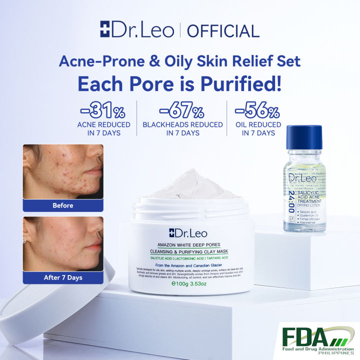 【Dr.Leo Fast Acne Set 】Acne Essence Salicylic Acid Anti-acne Essence ...