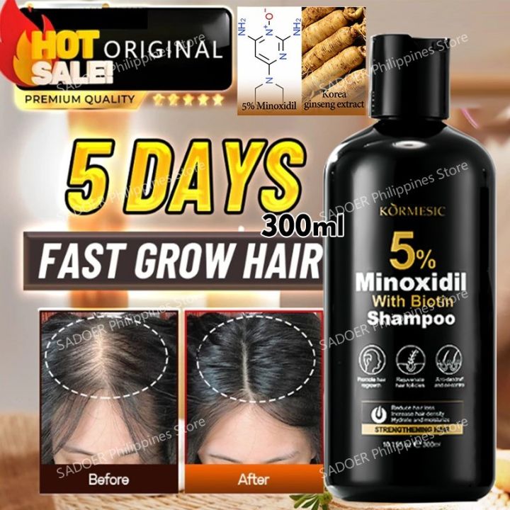 Minoxidil 5 Biotin Hair Growth Shampoo And Conditioner 300ml for Hair ...