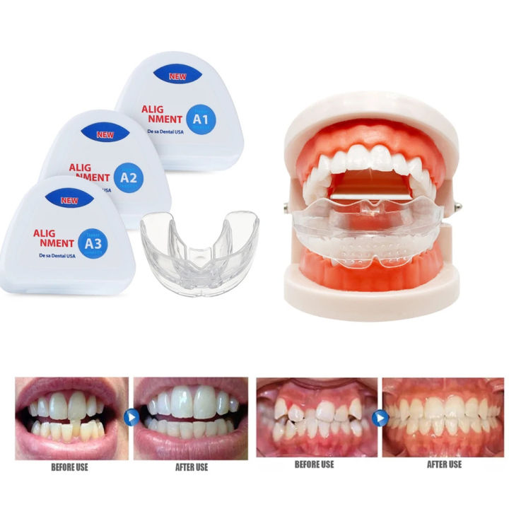 Dental Orthodontic Appliance Tooth Orthodontic Braces Trainer Dental ...