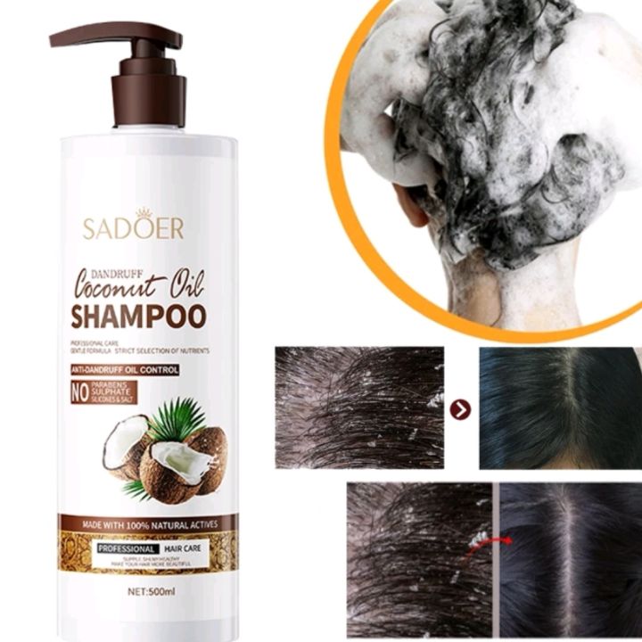 Coconut Oil Shampoo Anti-Dandruff Refreshing Control Oil Fluffy Repair Frizz Hair Shampoo 500ml ...