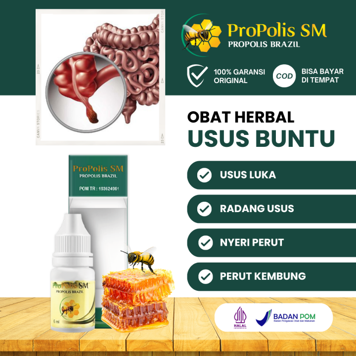 Propolis SM Obat Usus Buntu, Radang Usus Buntu, Usus Luka, Nyeri Perut ...