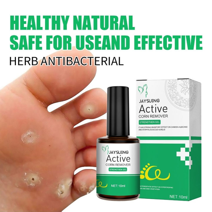 【3วันเจอผล】【ทดลองใช้ฟรี 7 วัน】10Ml Remove Foot Corn Care Cream ...