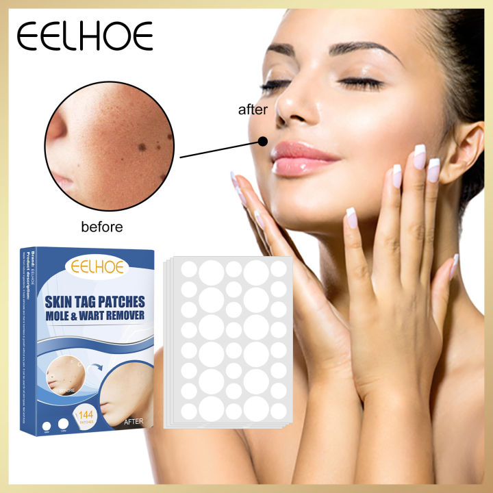 Eelhoe Skin Tag Patches Mole&Wart Remover Gift Wart Treatment Liquid ...