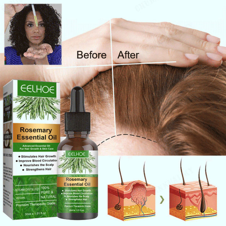 【juelreou】rosemary Hair Growth Essential Oil Anti Hair Loss Repair