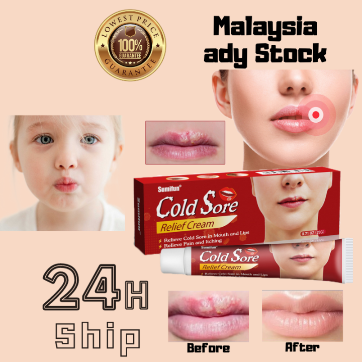 20g Cold Sores Lip Care Cream Repair Cheilitis Lips Herpes Ulceration Antibacterial Ointment
