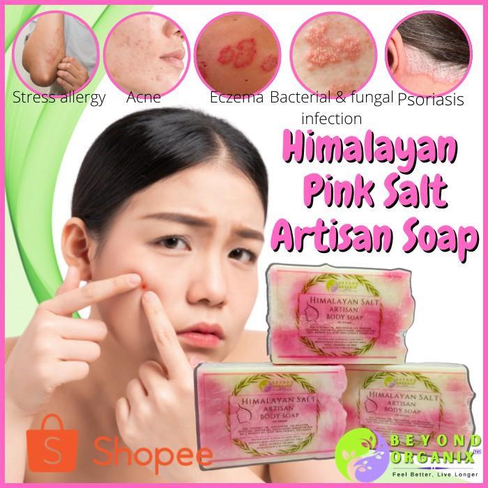 Pure Pink Himalayan Artisan Soap (Anti-Acne Pimple Breakout Natural ...
