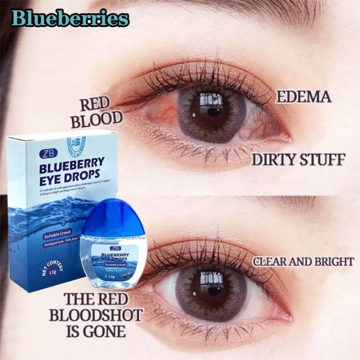 Blueberry Eye Drops Itchy Eyes Glaucoma , eye drops , Dry Eyes ...