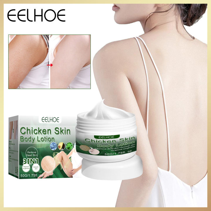 Eelhoe Chicken Skin Body Lotion Skin Repair Cream Curing Keratosis