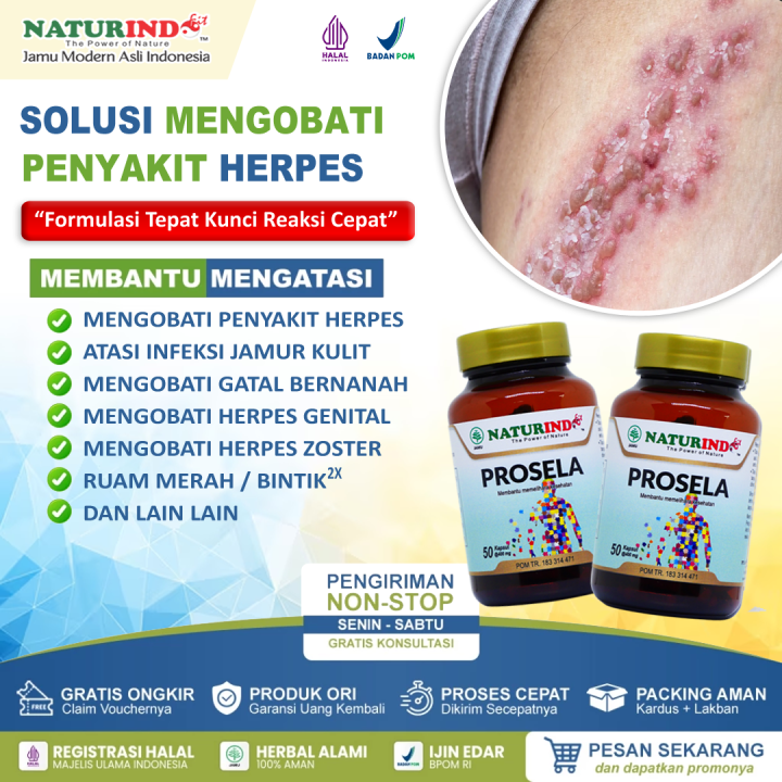 Obat Herpes Paling Ampuh Herpes Zoster Simplek Gatal Gatal Iritasi ...