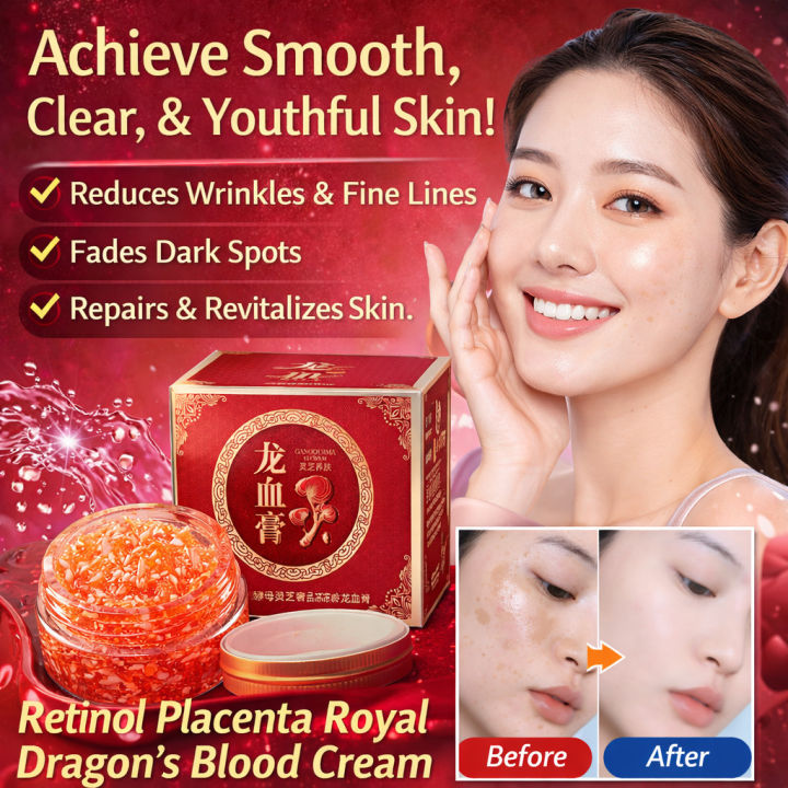 Retinol Placenta Royal Dragon’s Blood Cream Whitening Moisturizing ...