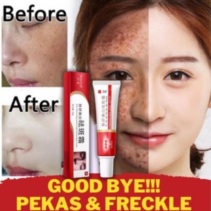 Pekas Remover Effective Melasma Cream Anti Freckle Collagen Original ...
