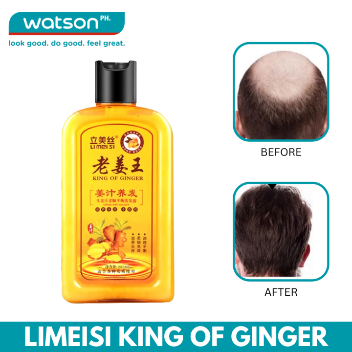 WATSON Ginger Shampoo Anti Hair Loss shampoo Hair Growth ginger scalp ...