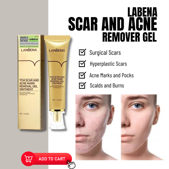 Original Labena TCM Scar And Acne Mark Removal Gel Ointment 30g | Lazada PH