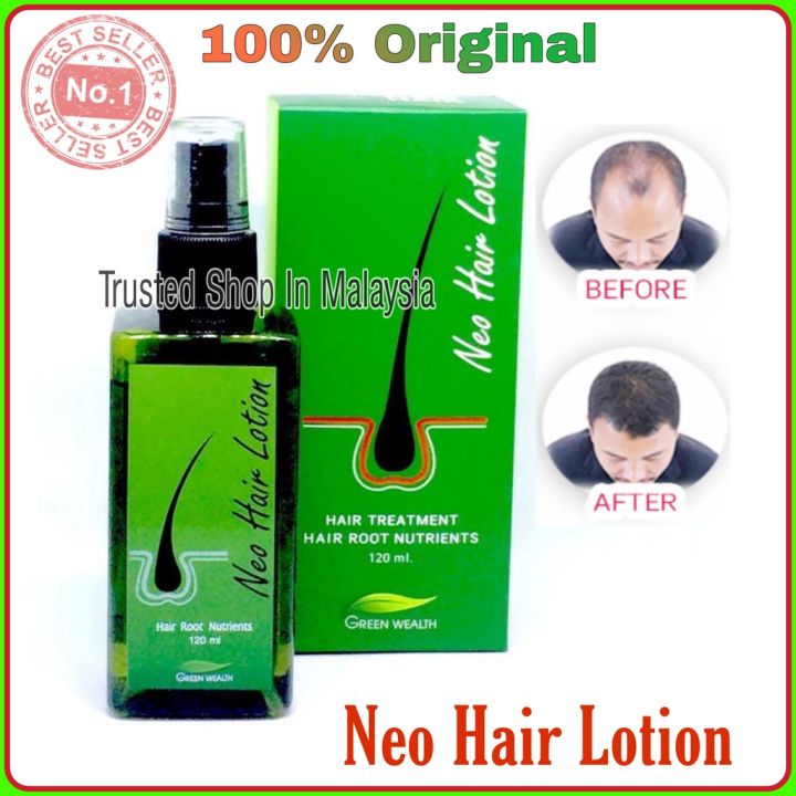 Neo Hair Lotion 100% Original 120ml Hair Spray Hair Transplant and Hair ...