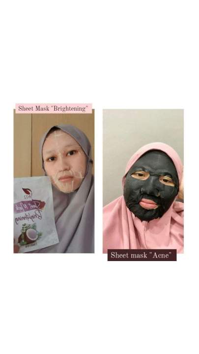 SHEET MASK ACNE & BRIGHTENING SR12 isi 5 pcs | masker tissue untuk ...