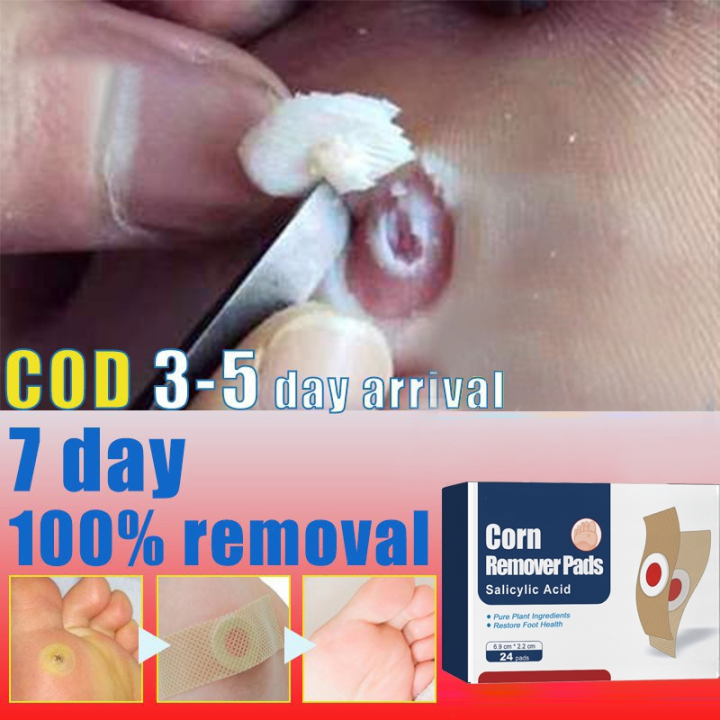 24PCS Salicylic Acid Warts Corn Remover Original To Remove Calluses On ...